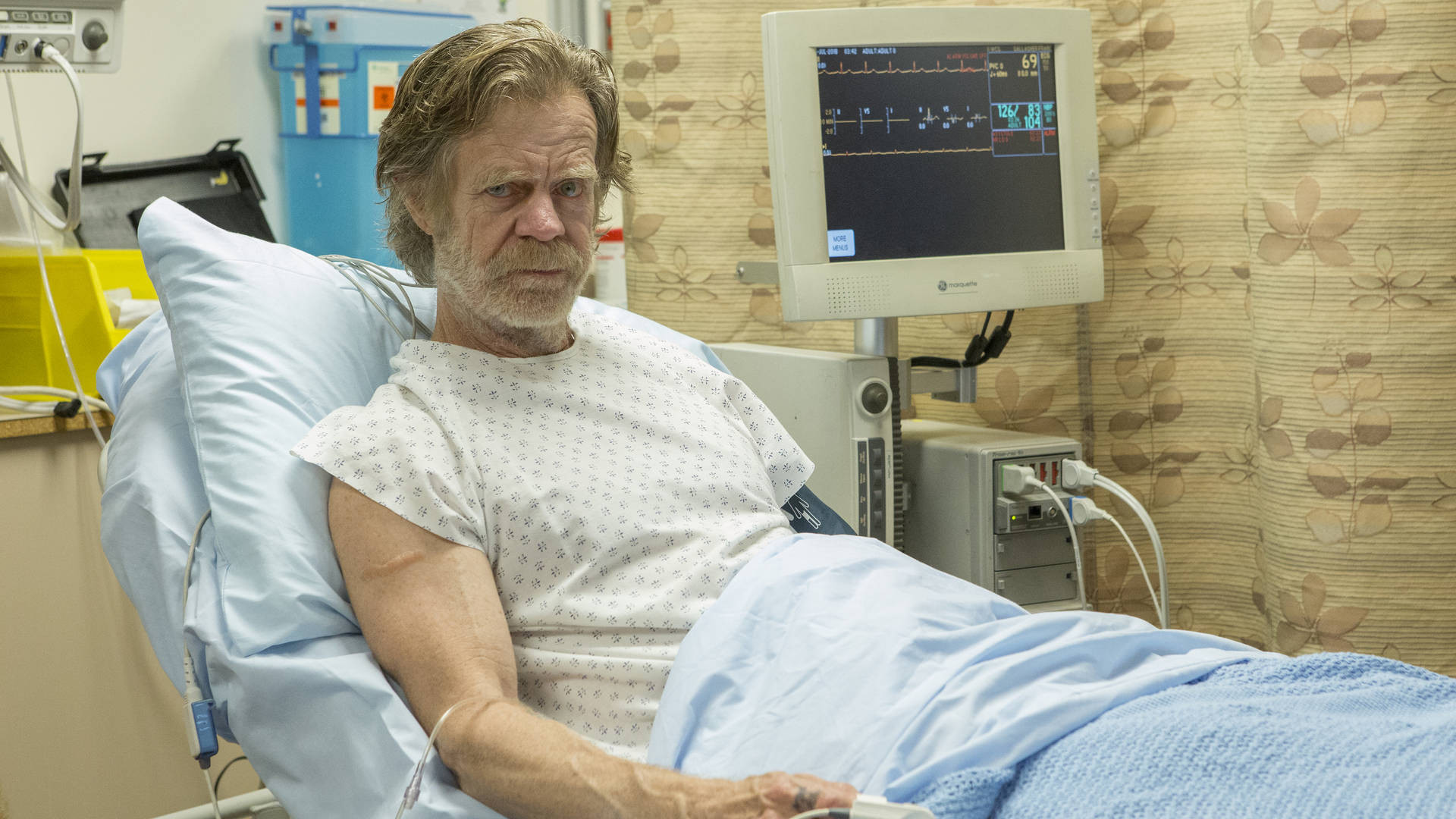 Shameless: Season 9 - Black-Haired Ginger (2018) - (S9E5) - Backdrops ...