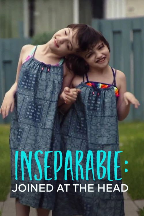 Inseparable: Ten Years Joined at the Head (2017) - Posters — The Movie ...